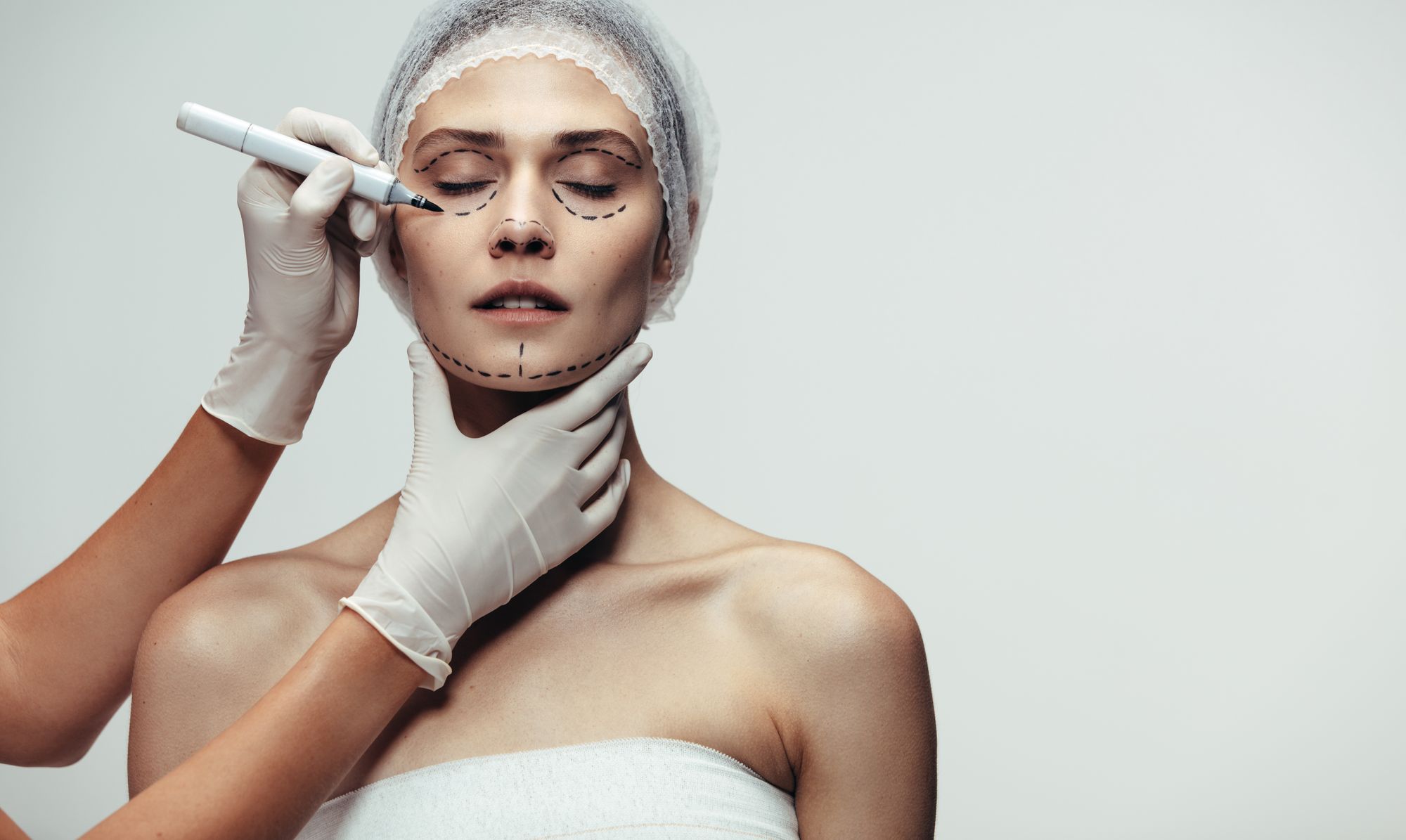 Harmonização Facial defeituosa e botox exagerado: como reparar esses ...